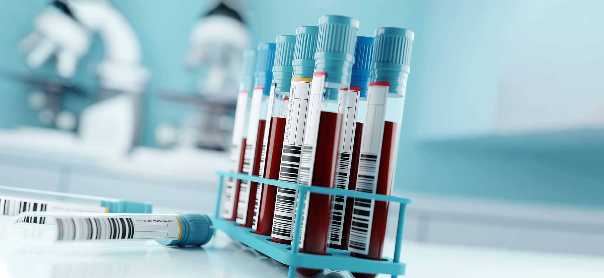 The Role of Routine Blood Work in Preventative Health Screening